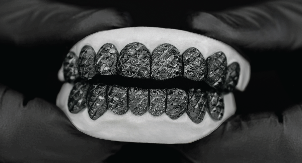 How Much Are Diamond Grillz? - RRP Diamond